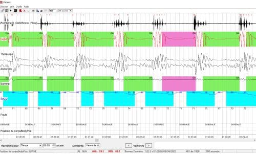 Polygraphe MediByte | CPAP STORE