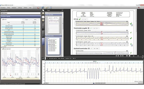 RTSoft Ultima - Logiciel R.Test Evolution 4 NOVACOR | CPAP STORE
